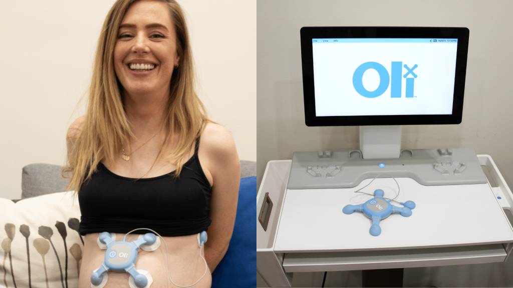 Oli raises $6.5m to predict birth complications before they happen
